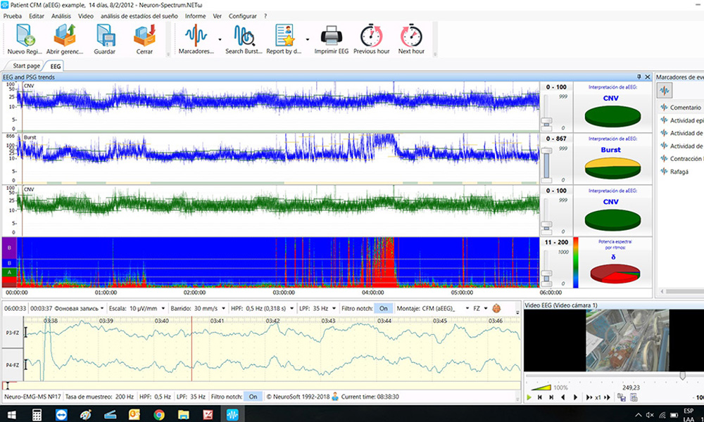 Monitor FC/aEEG - Soluciones para Neurofisiologia y Neurorehabilitacion