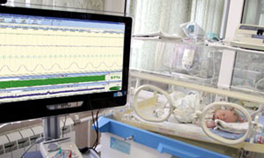 Monitor FC/aEEG - Soluciones para Neurofisiologia y Neurorehabilitacion