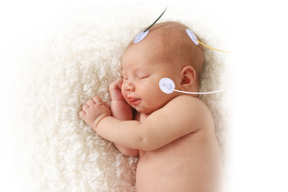 Monitor FC/aEEG - Soluciones para Neurofisiologia y Neurorehabilitacion